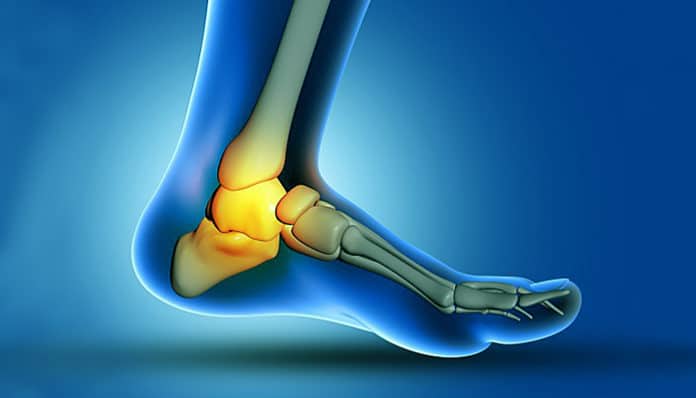 ČETIRI SPASONOSNA RJEŠENJA: Riješite se nepodnošljive boli u peti ...